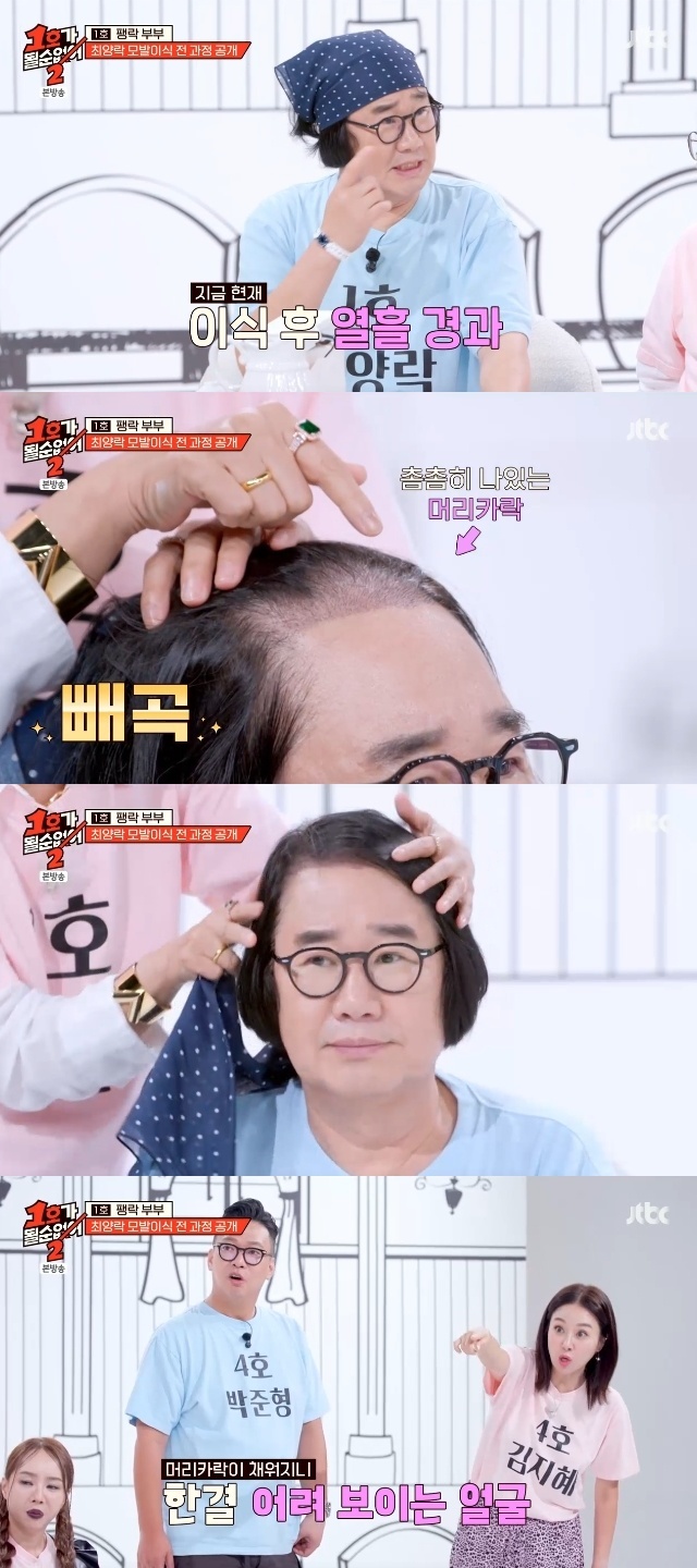 최양락 5014모 모발이식, 열흘만 빼곡해진 이마+어려진 얼굴(1호가) - 손에 잡히는 뉴스 눈에 보이는 뉴스 - 뉴스엔