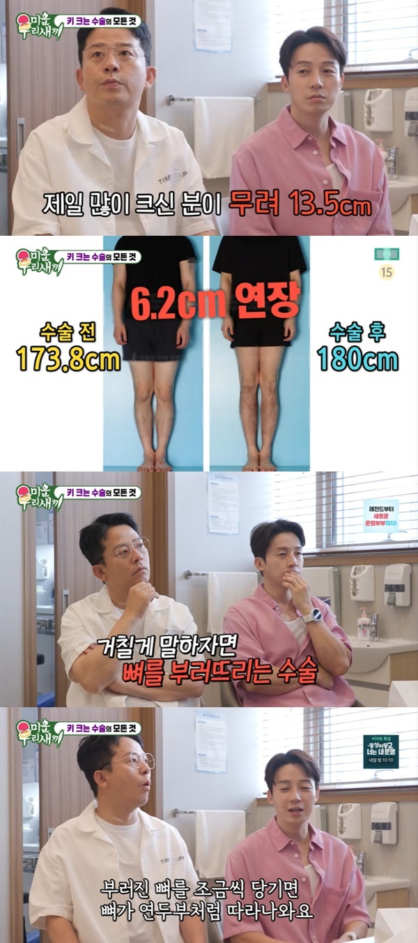“최소 4천만 원” 168㎝ 허경환 김준호, 사지 연장술 상담 ‘진지’ (미우새)[어제TV] - 손에 잡히는 뉴스 눈에 보이는 뉴스 - 뉴스엔